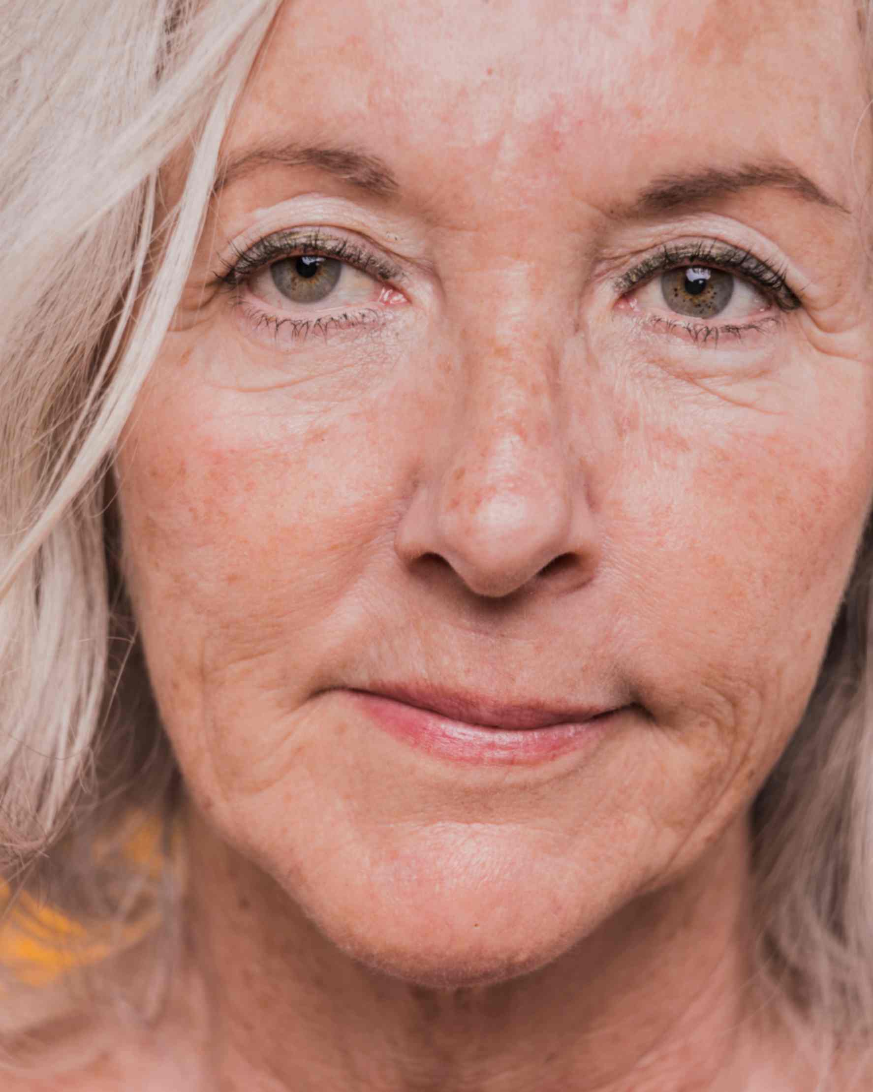 What is Age Spots? Best Ways to Fade Age Spots | Buy Wow