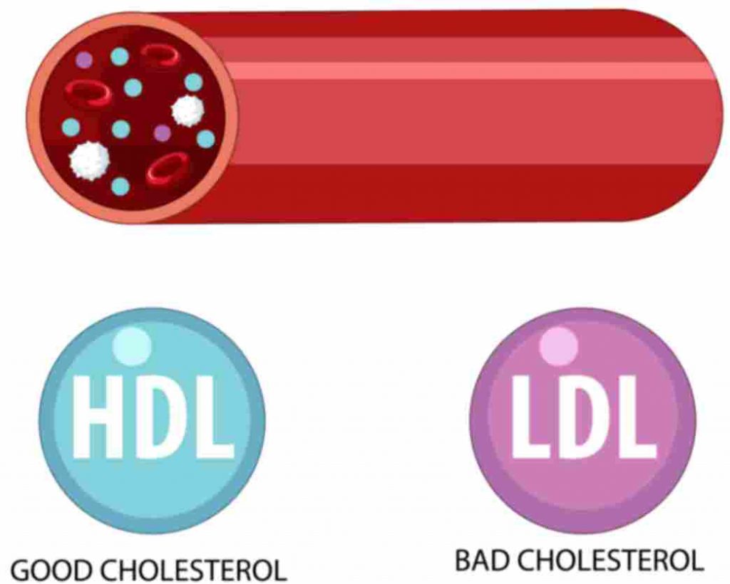 High Cholesterol? Causes, Symptoms, & Treatment | Buy Wow