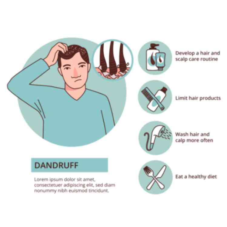 Dandruff and Hair Loss: Understanding the Connection | Buy Wow